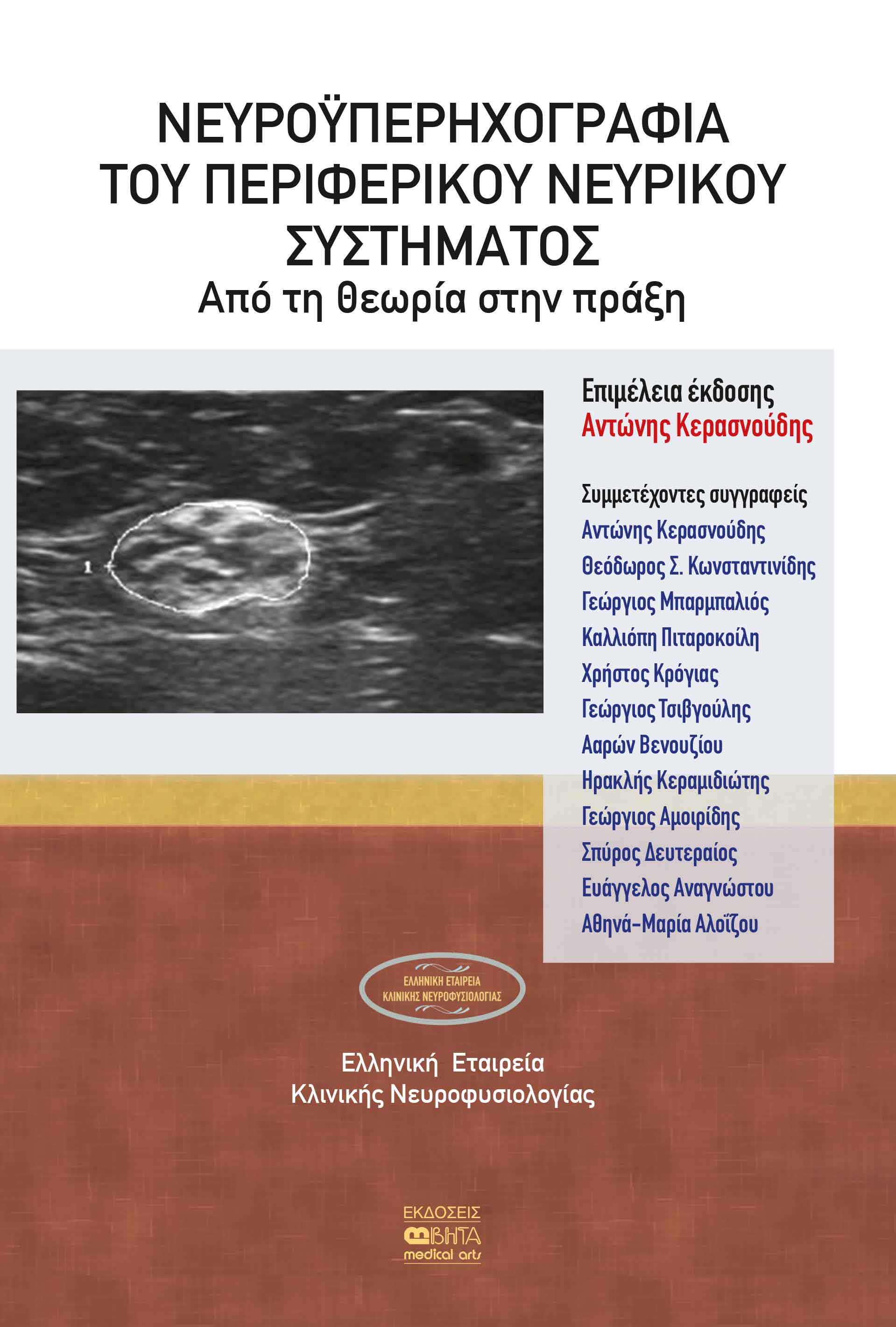 ΝΕΥΡΟΫΠΕΡΗΧΟΓΡΑΦΙΑ ΤΟΥ ΠΕΡΙΦΕΡΙΚΟΥ ΝΕΥΡΙΚΟΥ ΣΥΣΤΗΜΑΤΟΣ Από την θεωρία ...